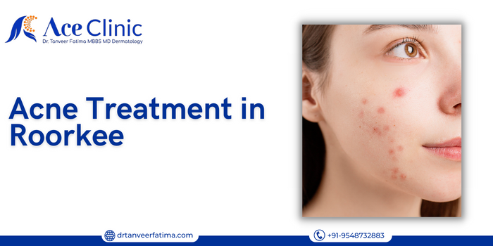 Best Dermatologist in Roorkee | Skin Specialist in Roorkee